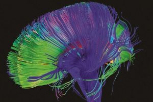 Introverts and Extroverts: The Brain Chemistry Behind Their Differences ...